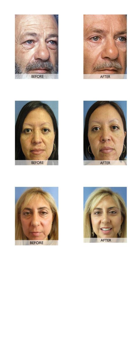 REVITALEYES GALLERY - Dr. George Brennan