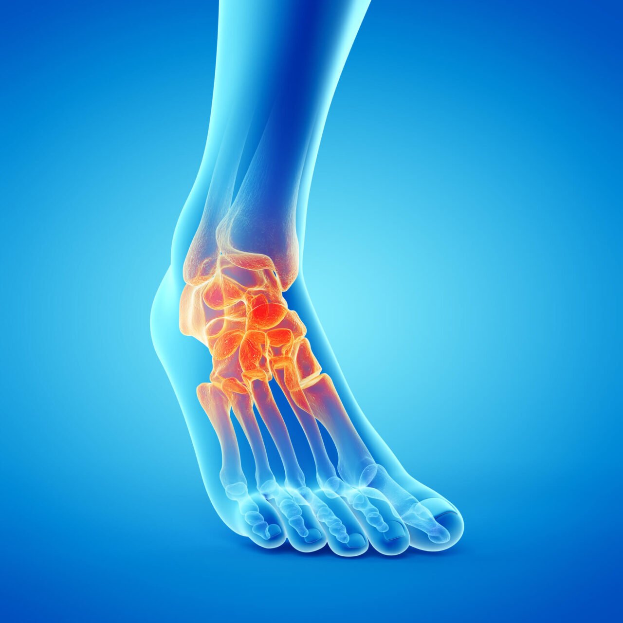 Cankle Reduction Orange County | Sleeker Ankles