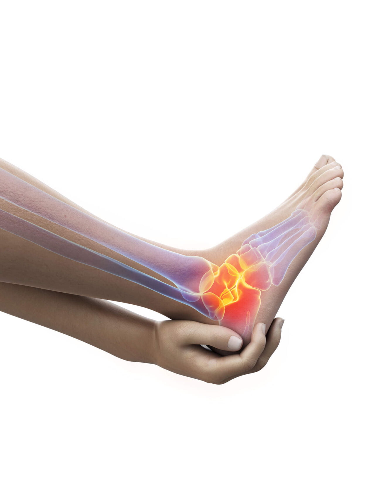 Cankle Reduction Orange County | Sleeker Ankles