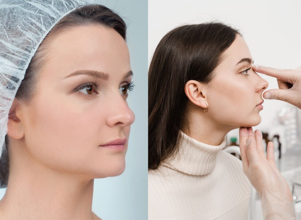 Difference Between Rhinoplasty and Septoplasty - Dr. George Brennan